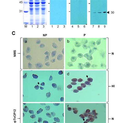 Effect Of Iron In The Expression Of T Vaginalis Tvcp12 Proteinase