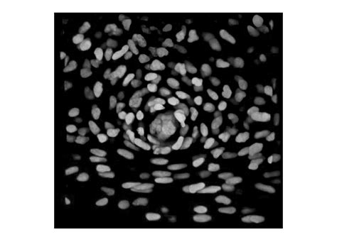 Basic Cell Counting And Segmentation In Matlab