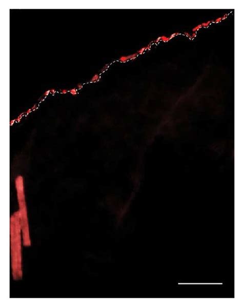 Localization Of α6 Integrin In The Interfollicular Epidermis And Download Scientific Diagram