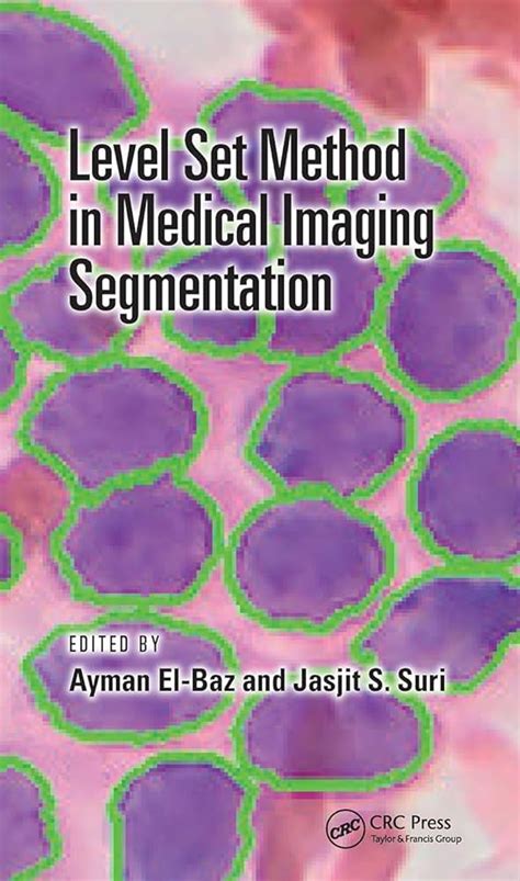 Level Set Method In Medical Imaging Segmentation Εκδόσεις Κωνσταντάρας