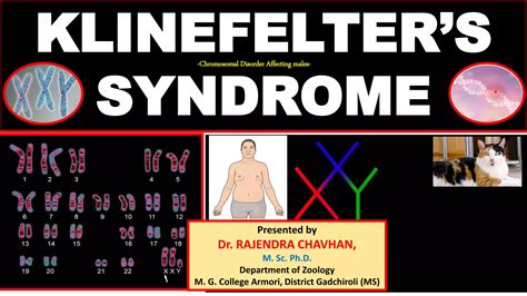 Klinefelter Syndrome Total Chromosomes