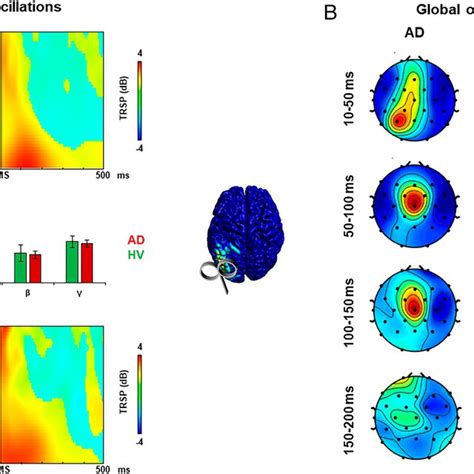 Oscillatory Activity Analysis After Left Posterior Parietal Cortex Download Scientific Diagram