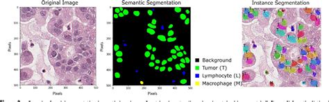 Figure 3 From Pathology Image Analysis Using Segmentation Deep Learning Algorithms Semantic