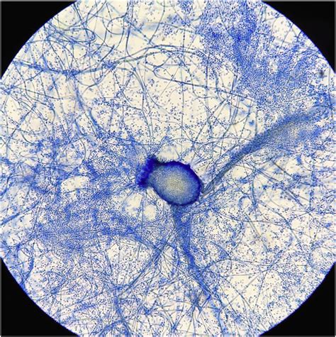 Pyrenochaeta Unguis Hominis Lactophenol Stain 400× Magnification Download Scientific Diagram