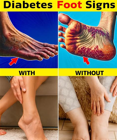 The Ultimate Secret To Supercharged Leg Circulation Just 6 Exercises