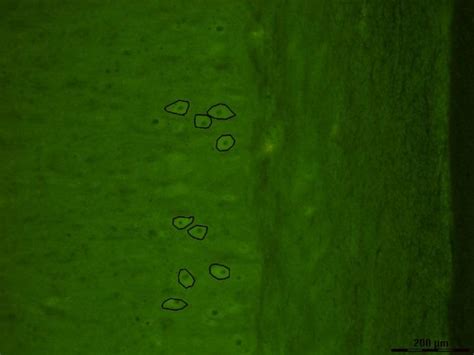 Laser Microdissection Extract Specific Regions From Your Sample Euro Bioimaging