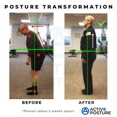 Ready To Start Your Posture Transformation Look And Feel Your Best Activ8 Posture