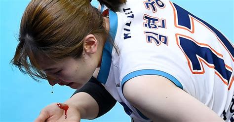 스파이크 맞고 피 흘리는 김현정 사진