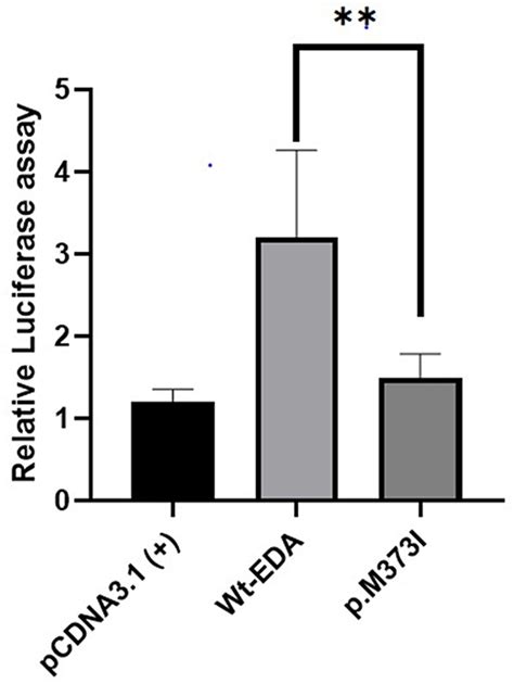 A Novel Ectodysplasin A Gene Mutation Ectodermal Dysplasia Ccid