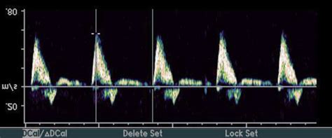 Waveforms Flashcards Quizlet