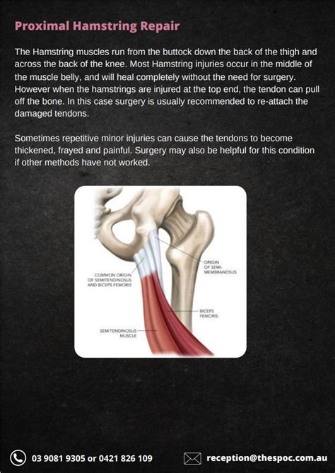 Proximal Hamstring Tendon