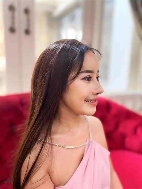 หนูรัตน์ ธิดาพร ชาวคูเวียง โชว์หน้าหลังผ่ากรามครบ 2 เดือน จำแทบไม่ได้