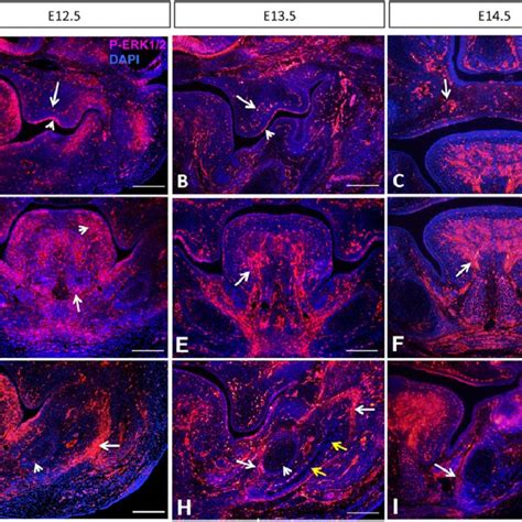 Cranial Neural Crest Cell Derived Tendons Are Abnormal In Wnt1 Creerk2