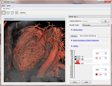 GitHub RWTHmediTEC DICOMViewer GUI For Visualization Of DICOM Datasets Using CARNA