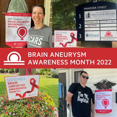 The Brain Aneurysm Foundation Op Linkedin Scan2save Baf 1in50