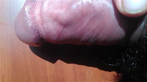 My Banded Cock