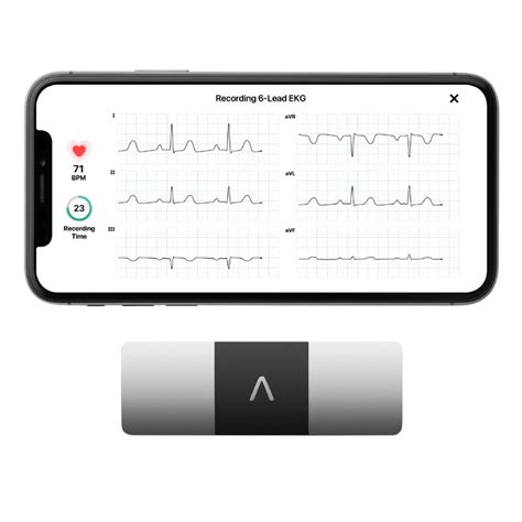 Ecoa Clinical Trials Clario