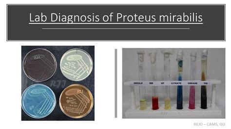 Identification Of Gram Negative Bacilli Part 1 Ppt