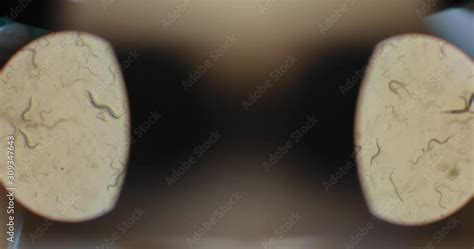 A Colony Of Microorganisms C Elegans Caenorhabditis Elegans Nematode