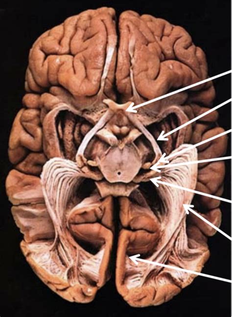 Another Diagram Diagram Quizlet