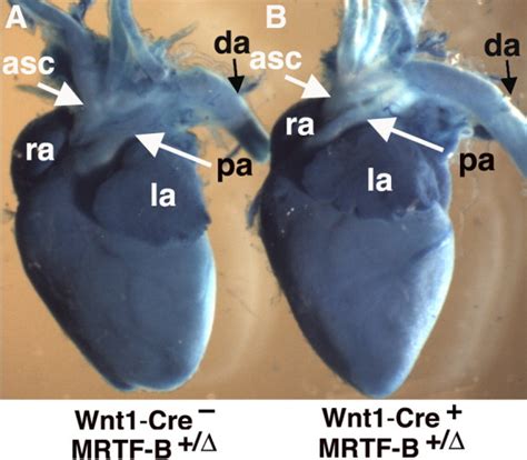 Myocardin‐related Transcription Factor B Is Required For Normal Mouse Vascular Development And