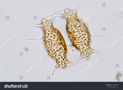 Dinophysisdinoflagellate Marine Protozoa Under Microscope Stock Photo Shutterstock