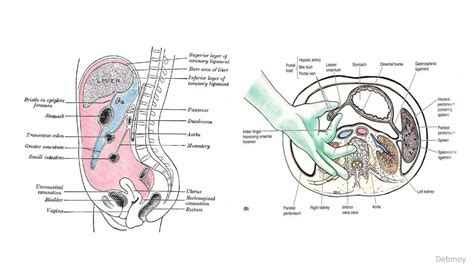 Retrohepatic Ivc Injuries Evaluation And Assessment Pptx