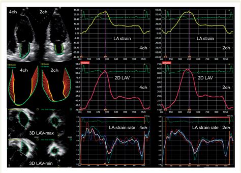 Figure 1 From Echocardiographic Reference Ranges For Normal Left Atrial Function Parameters