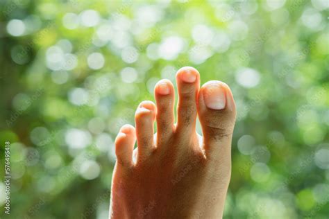 Greek Foot Fingers Feet And Toenails Exposed With Natural Light And