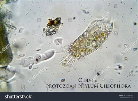 Microscopic Photograph Ciliate Protozan Phylum Ciliophora Foto Stock
