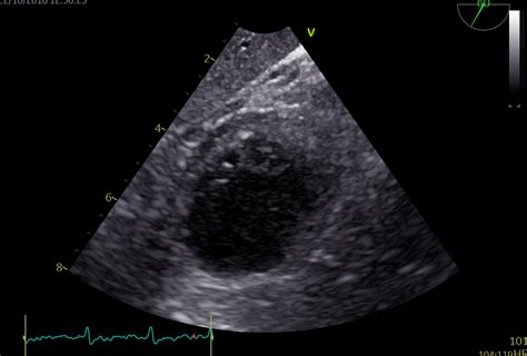 Python Video Crop With Automatic Specific Contour Recognition Stack Overflow