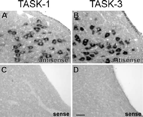 Speci Fi City Of Task 3 And Task 1 Labeling Using Nonradioac Tive Crna Download Scientific