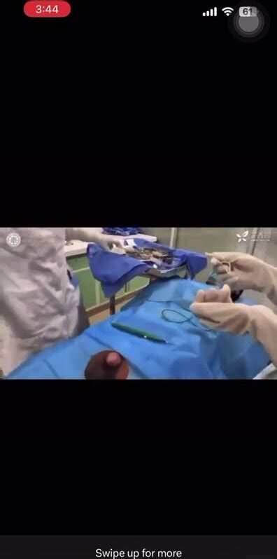 Circumcision Video 18
