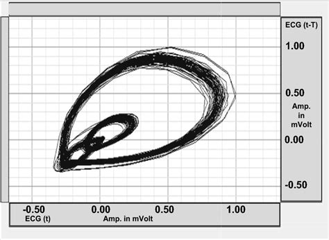 chaos analysis of 103 m mit bih arrhythmia sample of 1 min duration at download scientific