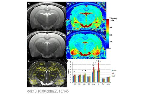brain mapping lab on linkedin nbml brain mapping mri pulse sequence