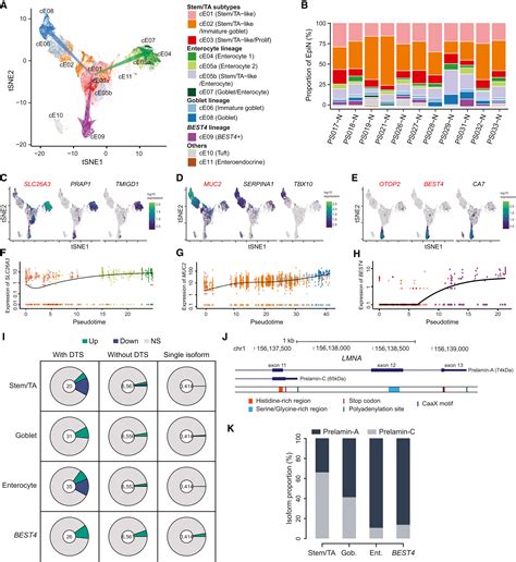 An Isoform Resolution Transcriptomic Atlas Of Colorectal Cancer From