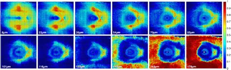 Enhanced Objective Detection Of Retinal Nerve Fiber Bundle Defects In Glaucoma With A Novel