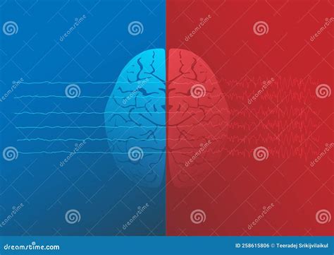 Concept Of Human Normal Brain And Epileptic Brain Stock Illustration