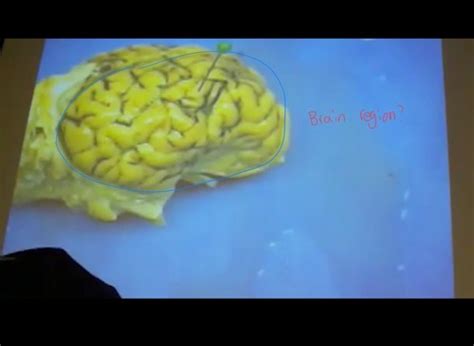 Bio Lp 4 Brain Flashcards Quizlet