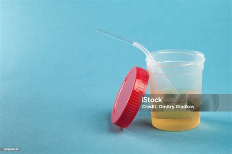 소변과 빨간색으로 뚜껑을 열 옆에 파란색 배경에 음주 튜브와 의료 검사를위한 항아리 개념 소변 치료 마시기에 대한 스톡 사진 및 기타 이미지 Istock