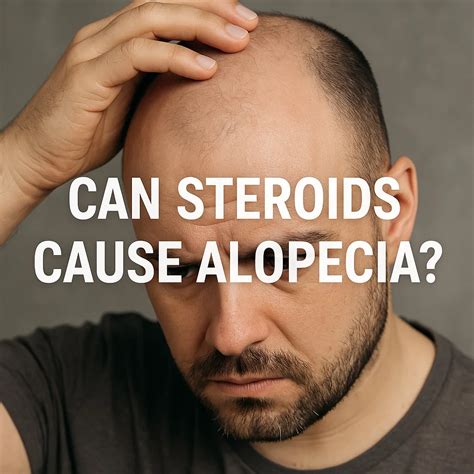 Can Steroids Cause Alopecia Ghcanada