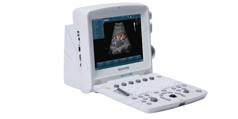 Demo Unit Edan U50 Prime Ultrasound System Vue Imaging
