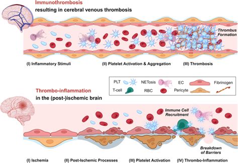 Immunothrombosis Versus Thrombo Inflammation Platelets In Cerebrovascular Complications Pmc