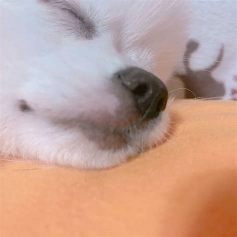 잡담 태어난 지 1년도 안 됐을때 한 깁스 짠한데 귀여워 인스티즈instiz 일상 카테고리