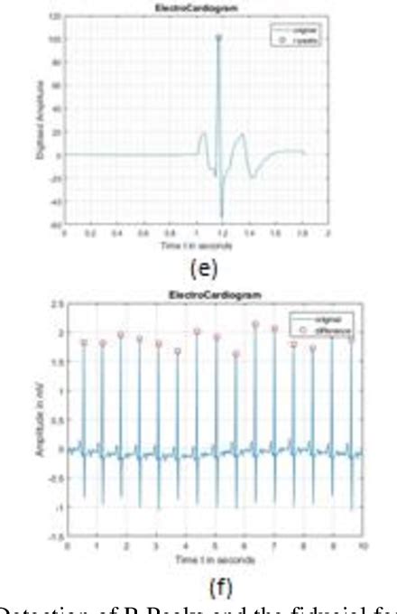 Figure 12 From Classification Of Arrhythmia From Ecg Signals Using Matlab Semantic Scholar