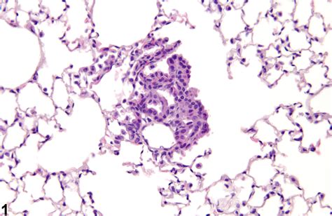 Epithelial Cells Alveoli