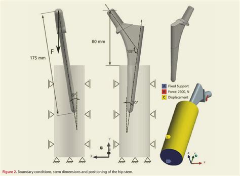 Figure 1 From Finite Element Simulation Of Femoral Stems Lightweighted With Re Entrant Honeycomb