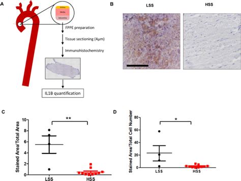 Aortic Tissues With Low Syntax Scores Show Strong Expression Of Il1b