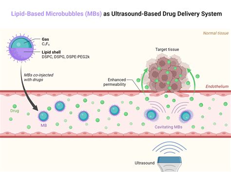 Lipid Based Microbubbles As Ultrasound Based Drug Delivery System