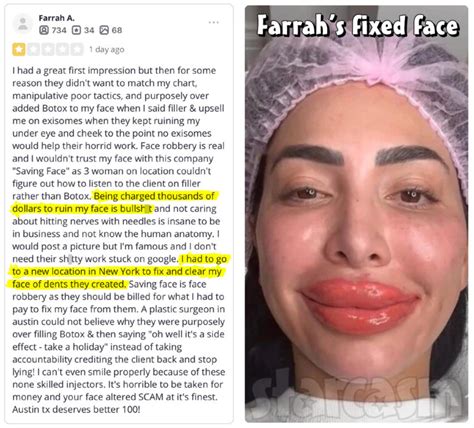 Farrah Abraham Has To ‘fix Her Face After ‘face Robbery Starcasm
